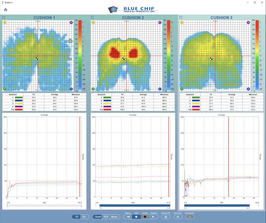 Pressure Mapping System for Wheelchairs & Seating - Blue Chip : Blue ...